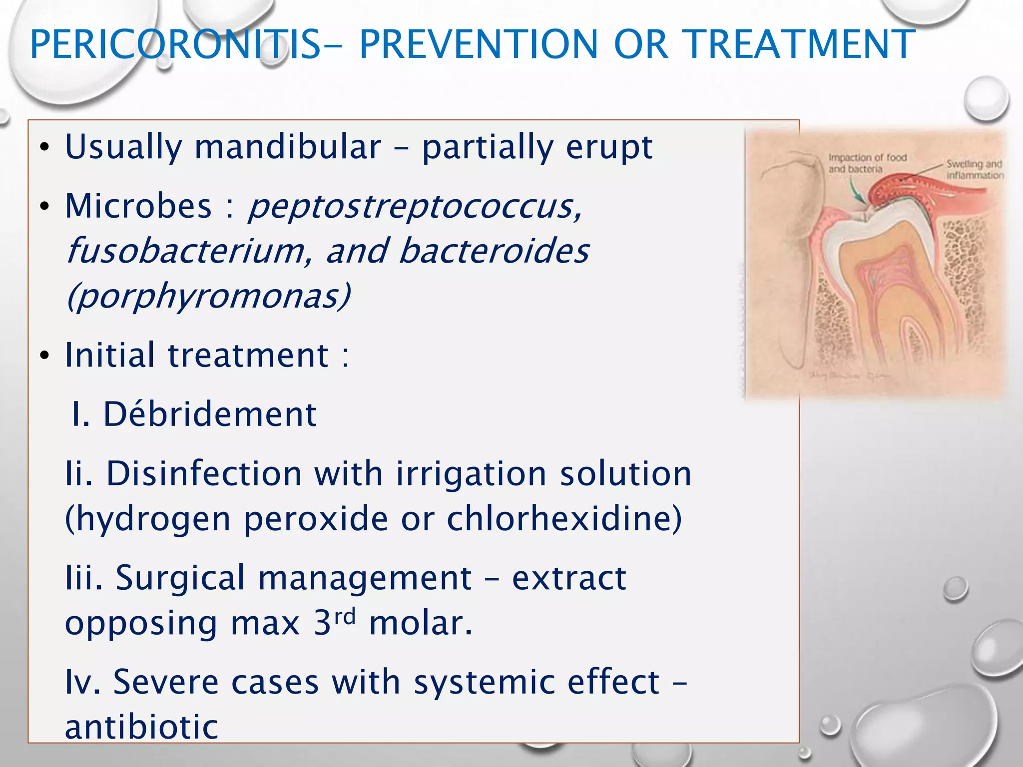 Third molar surgery | PPTX