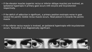 Third nerve- functional anatomy and clinical features | PPTX