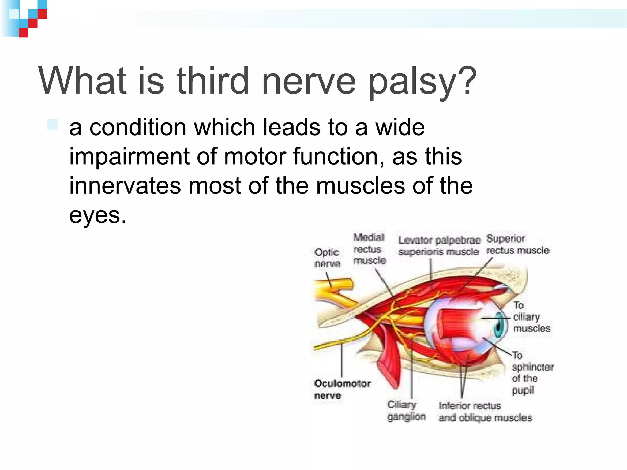 Case presentation: Third nerve palsy | PPT