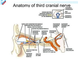 Case presentation: Third nerve palsy | PPT