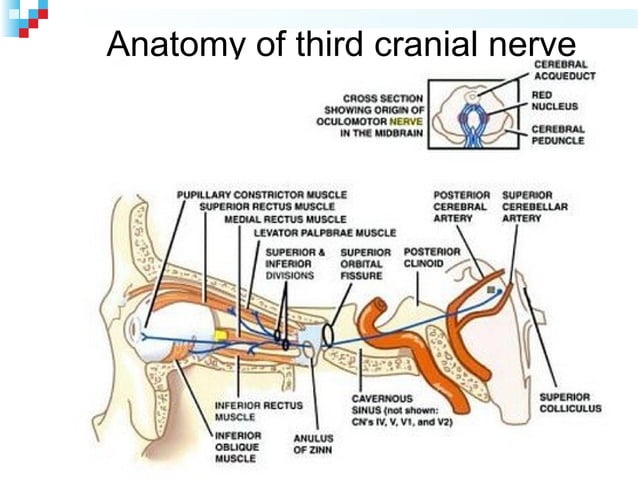 Case presentation: Third nerve palsy | PPT