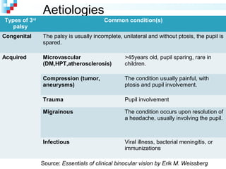 Case presentation: Third nerve palsy | PPT