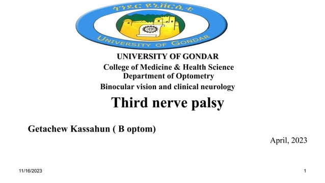 Third nerve palsy.pptx