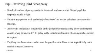 Third nerve palsy.pptx
