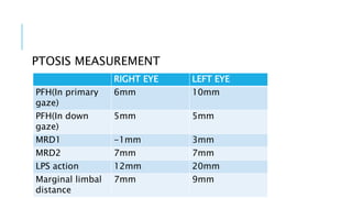 THIRD NERVE PALSY CASE PRESENTATION 2.pptx