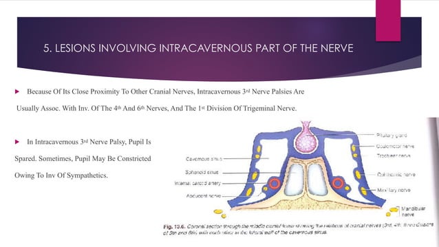 THIRD NERVE - ANATOMY AND APPLIED ASPECT. | PDF | Brain and Nervous ...