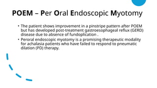 Third Space Endoscopy recent advances in the field | PPTX