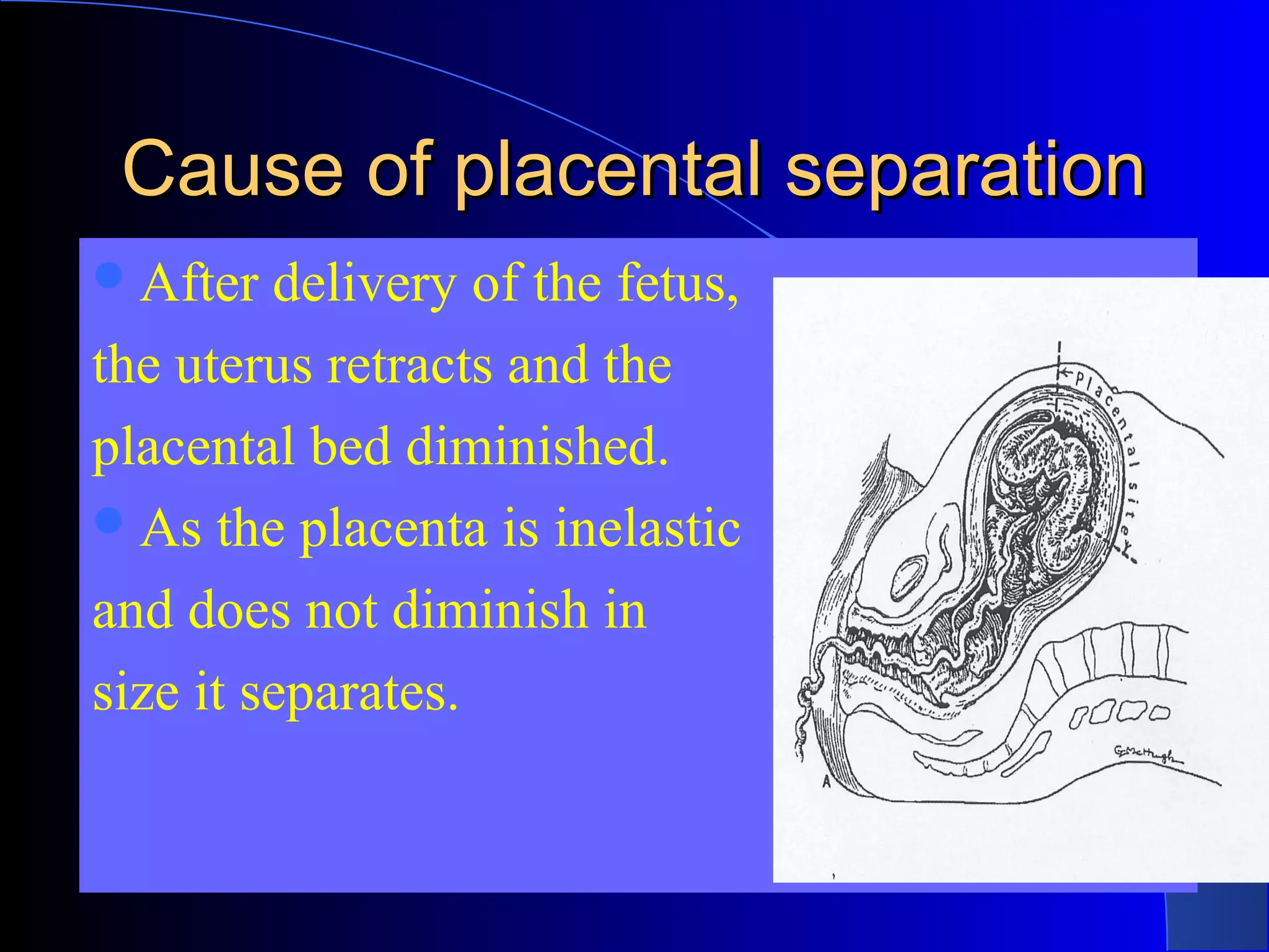 Third stage of labor for undergraduate | PPT