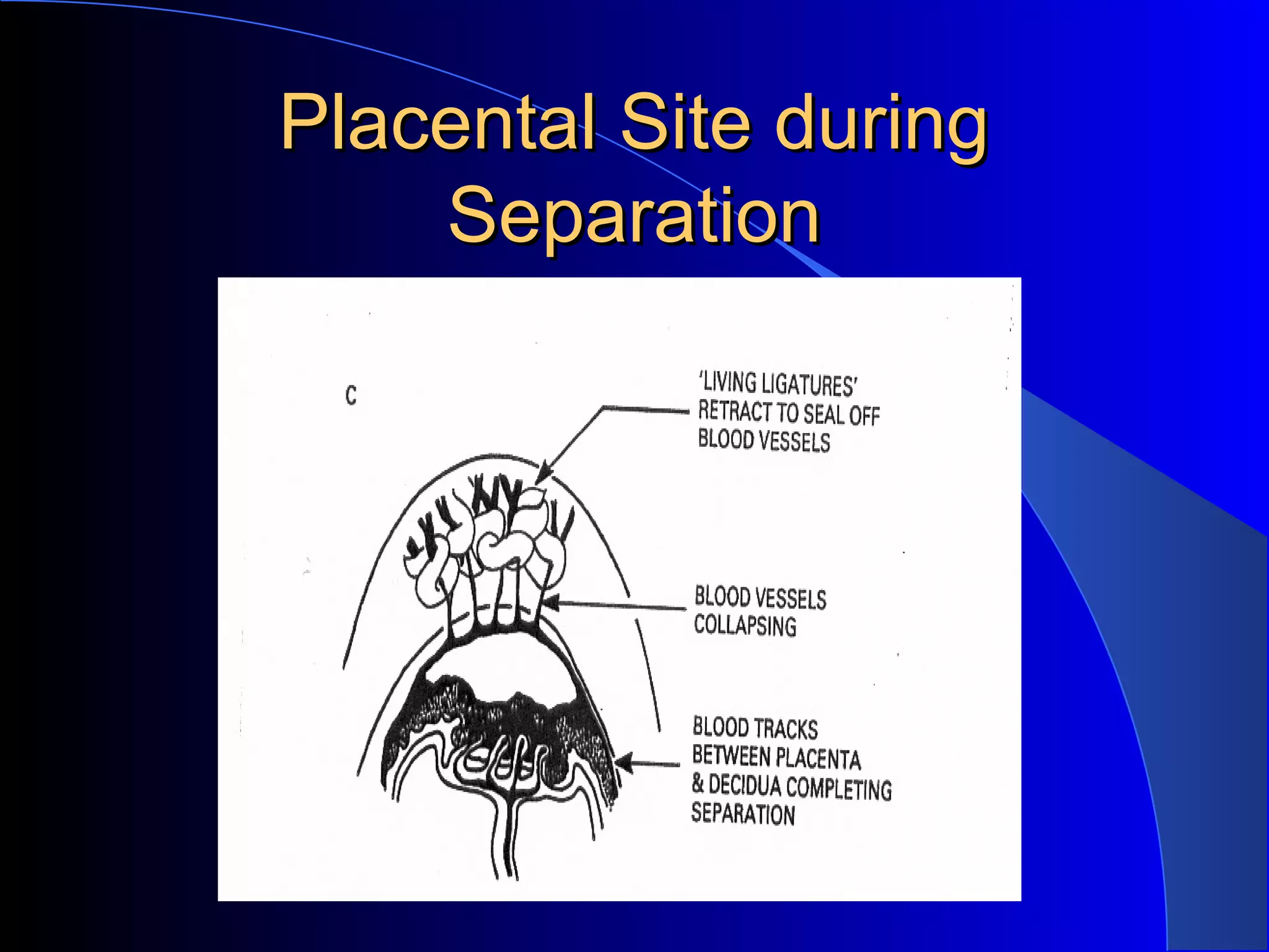 Third stage of labor for undergraduate | PPT