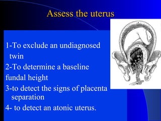 Third stage of labor for undergraduate | PPT