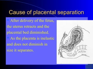 Third stage of labor for undergraduate | PPT