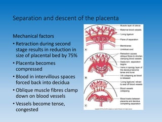 Third stage of labour | PPT