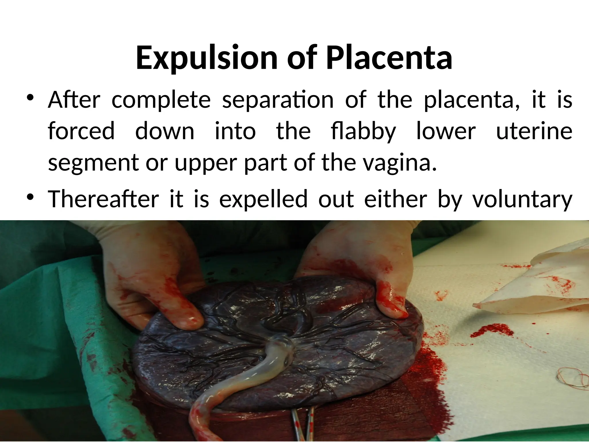 Third Stage of Labour.pptx methods of placental expulsion | PPTX