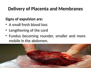 Third Stage of Labour.pptx methods of placental expulsion | PPTX ...