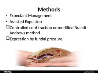 Third Stage of Labour.pptx methods of placental expulsion | PPTX ...