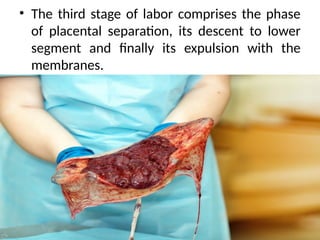 Third Stage of Labour.pptx methods of placental expulsion | PPTX ...