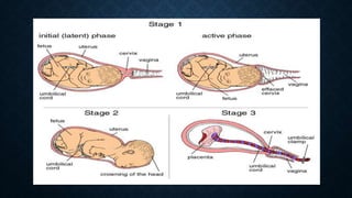 Third stage of labor and its management | PPTX