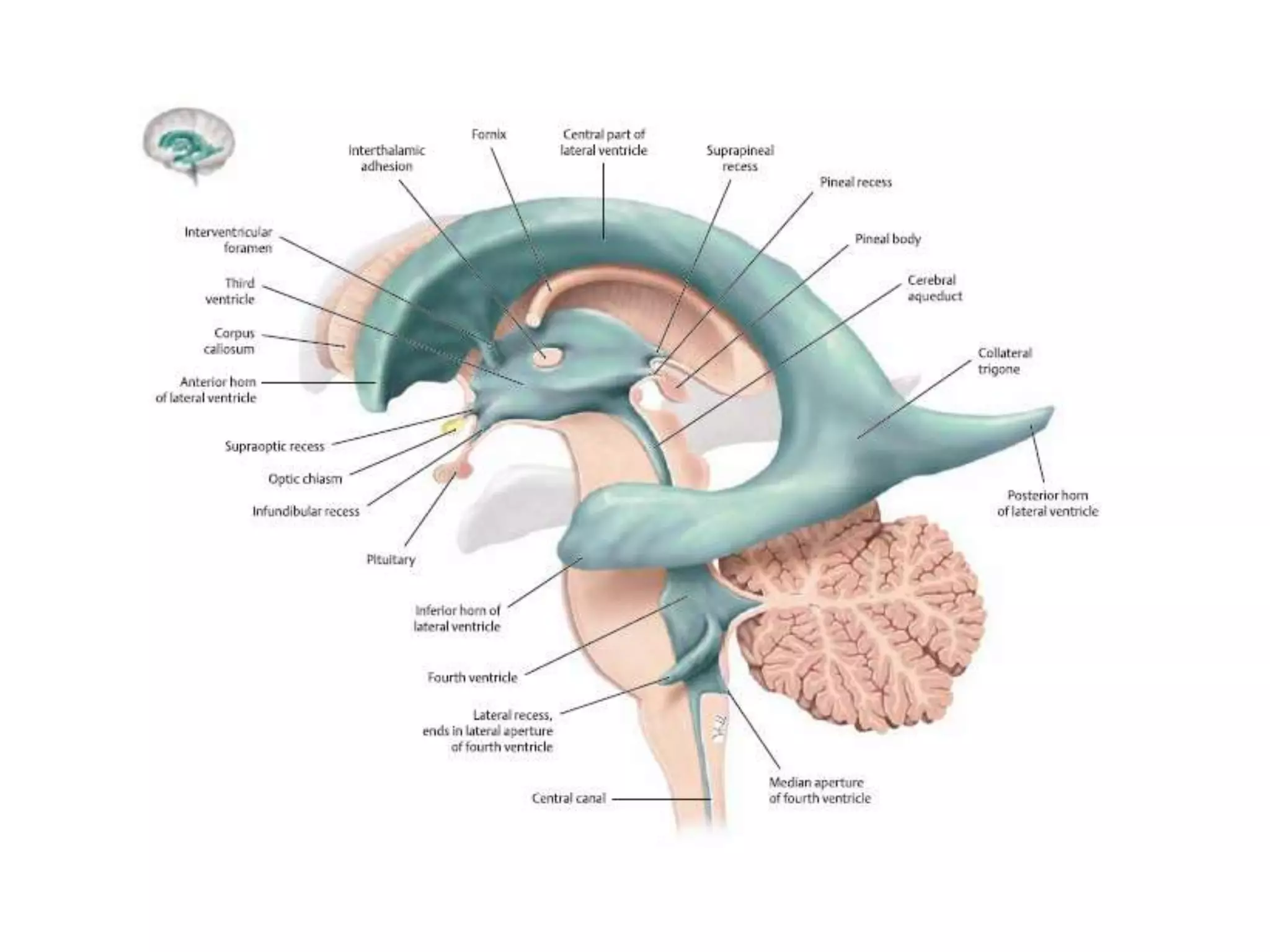 Third ventricle | PPTX