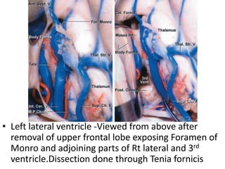 Third ventricle | PPTX