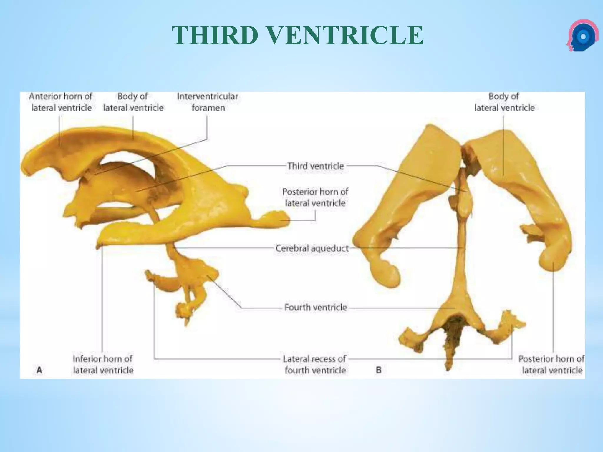 Third ventricular surgical approaches | PPTX