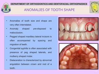 third year etiology of malocclusion.pptx