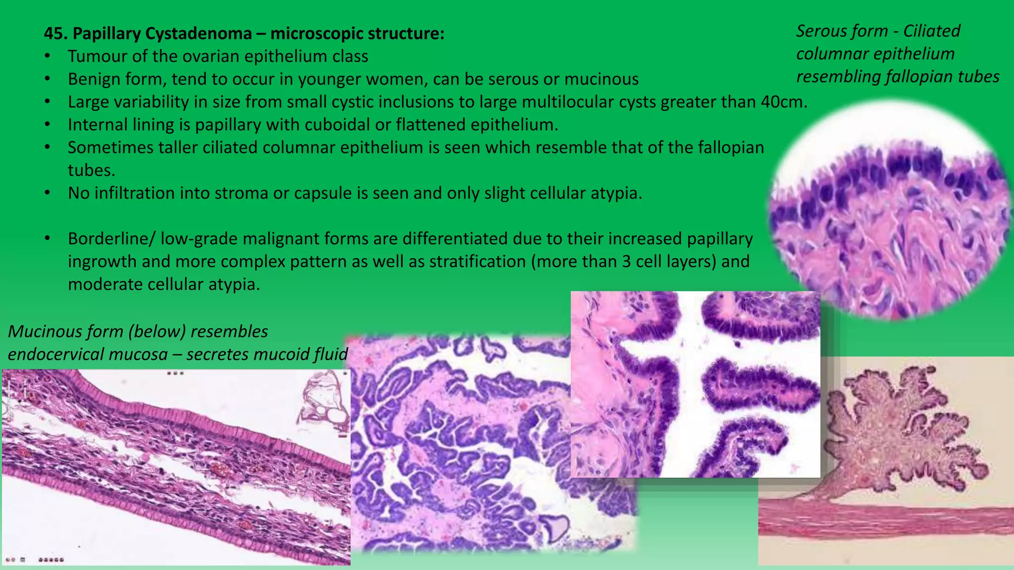 PMU third/fourth year Clinical pathoanatomy Part 2 | PPTX