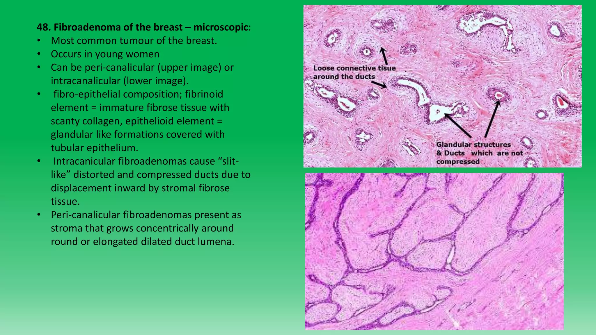 PMU third/fourth year Clinical pathoanatomy Part 2 | PPTX