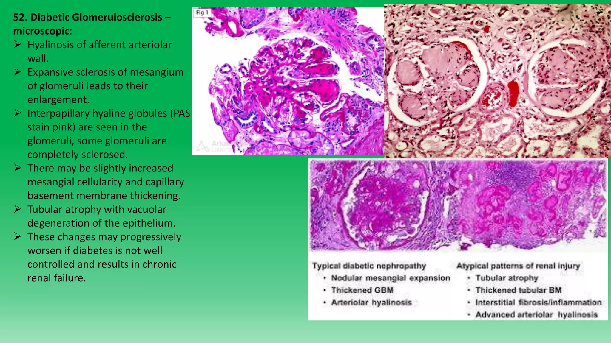 PMU third/fourth year Clinical pathoanatomy Part 2 | PPTX