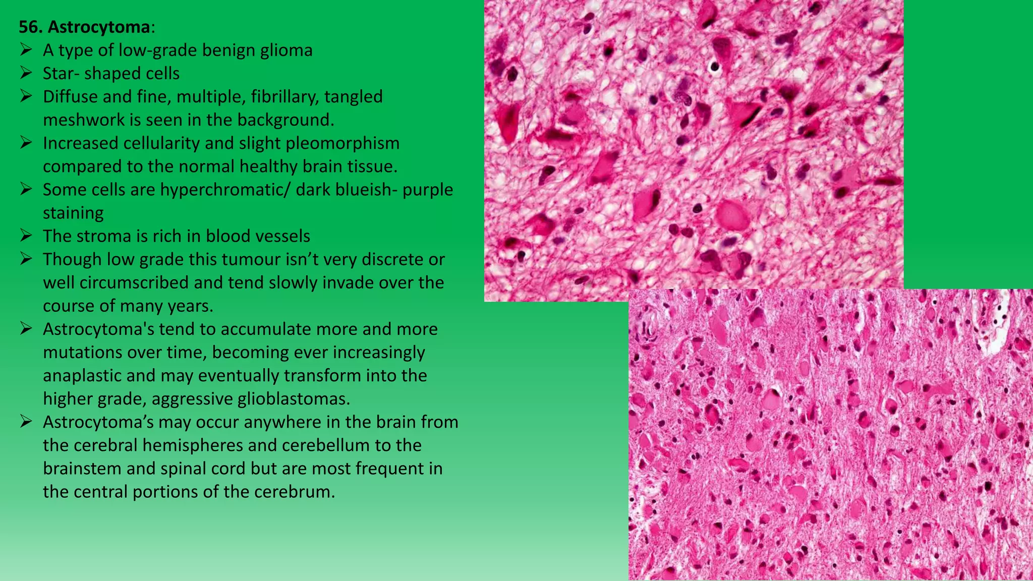 PMU third/fourth year Clinical pathoanatomy Part 2 | PPTX