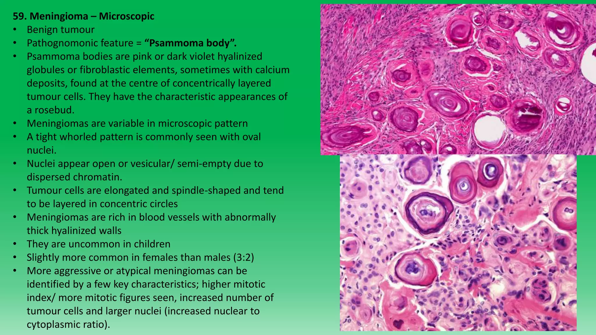 PMU third/fourth year Clinical pathoanatomy Part 2 | PPTX