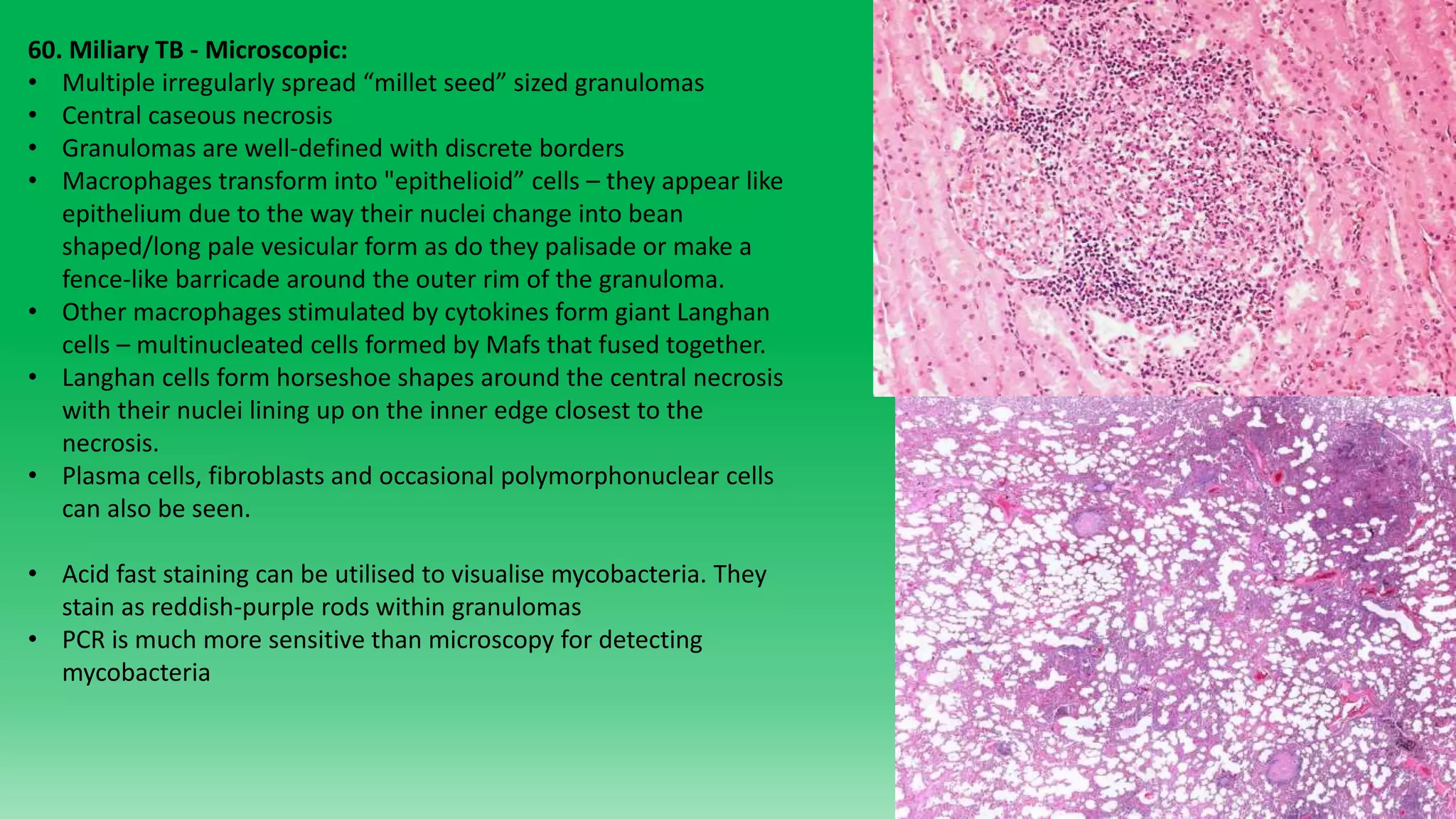 PMU third/fourth year Clinical pathoanatomy Part 2 | PPTX