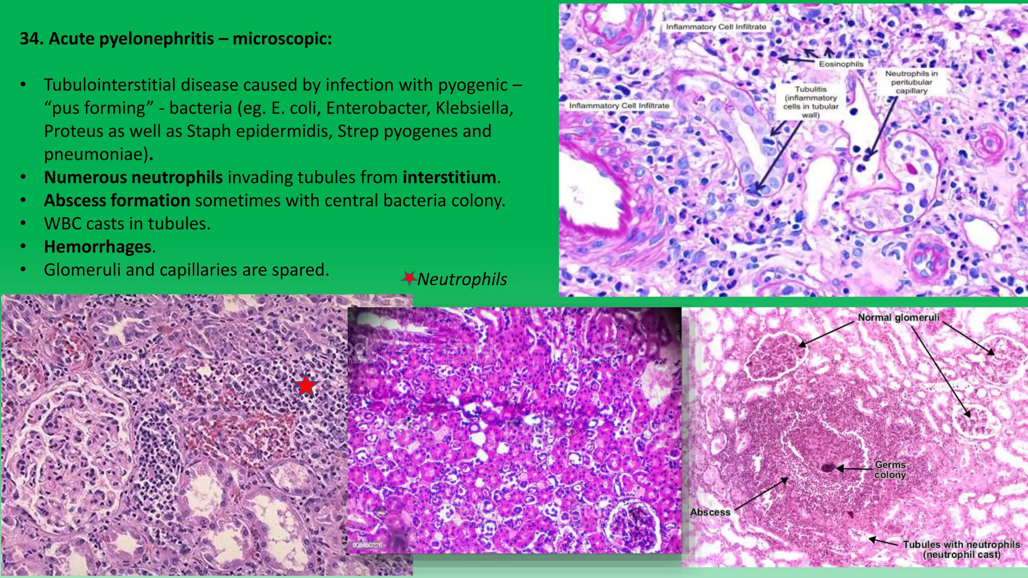PMU third/fourth year Clinical pathoanatomy Part 2 | PPTX