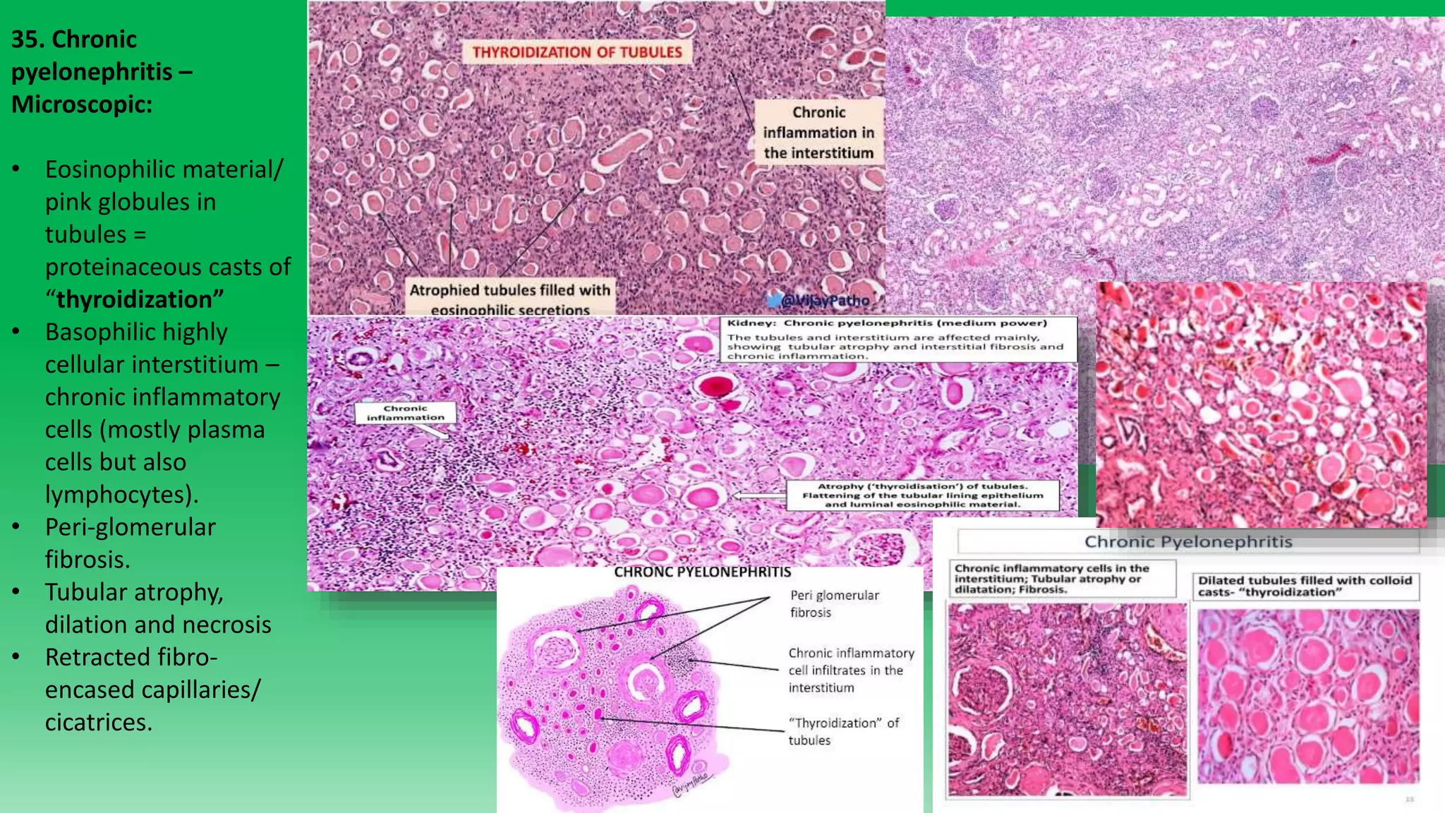 PMU third/fourth year Clinical pathoanatomy Part 2 | PPTX