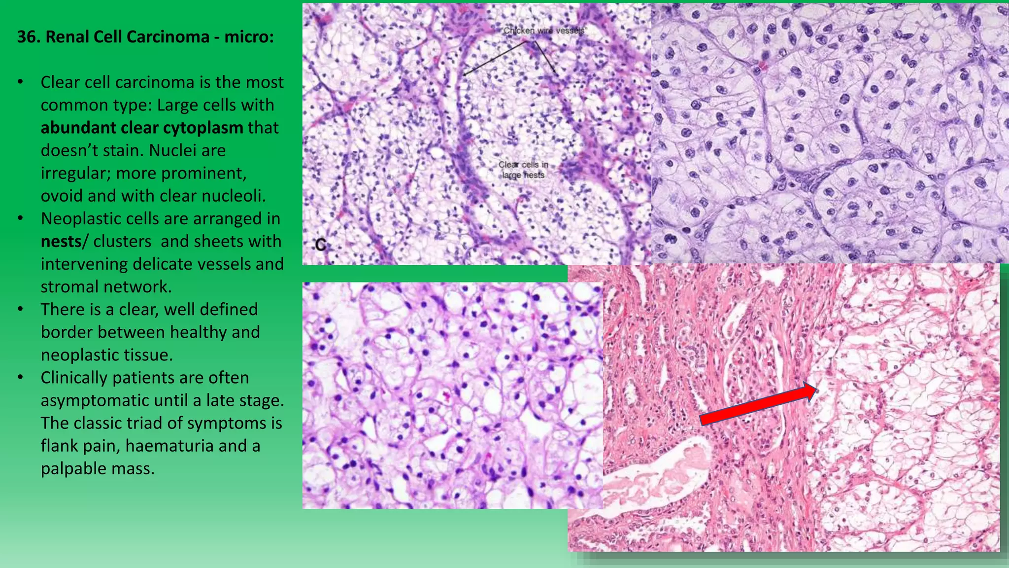 PMU third/fourth year Clinical pathoanatomy Part 2 | PPTX
