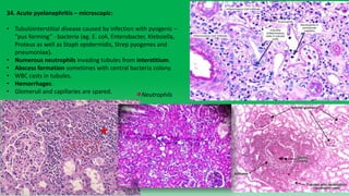 PMU third/fourth year Clinical pathoanatomy Part 2 | PPT