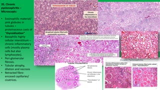 PMU third/fourth year Clinical pathoanatomy Part 2 | PPT
