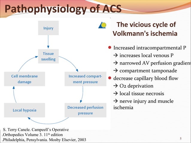 Compartment syndrome, acute, chronic, anatomy and operation | PPT