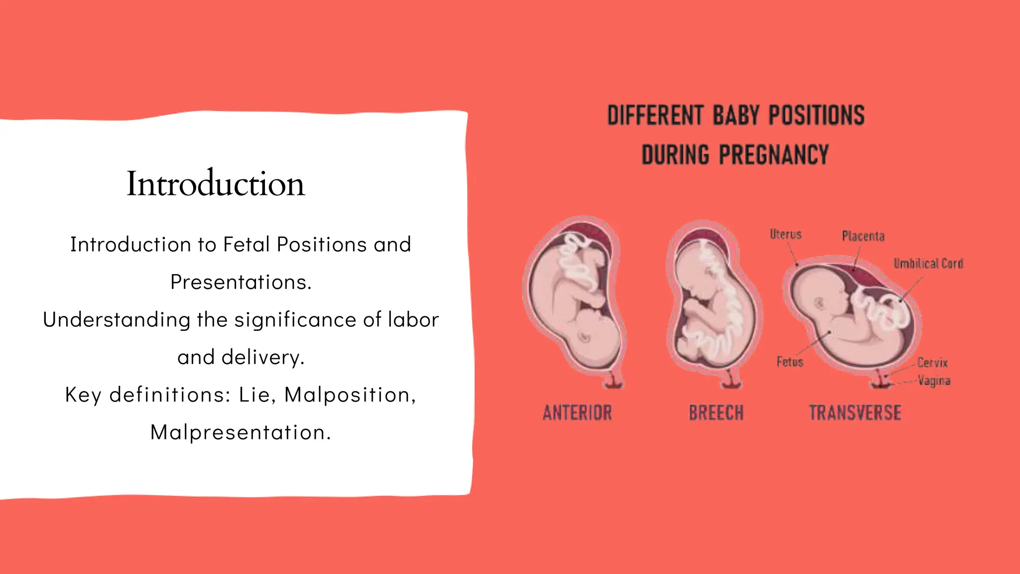 THIVYAROOBINI PRESENTATION ABNORMAL LABOUR .pptx