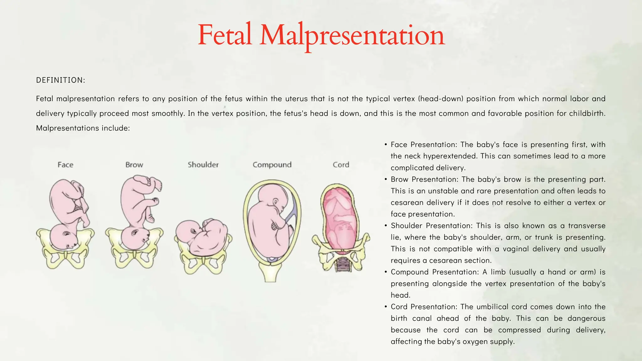 THIVYAROOBINI PRESENTATION ABNORMAL LABOUR .pptx