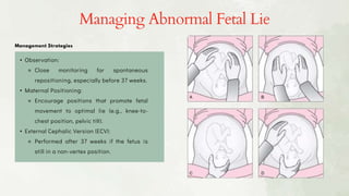 THIVYAROOBINI PRESENTATION ABNORMAL LABOUR .pptx