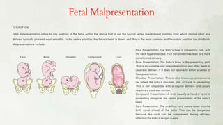 THIVYAROOBINI PRESENTATION ABNORMAL LABOUR .pptx