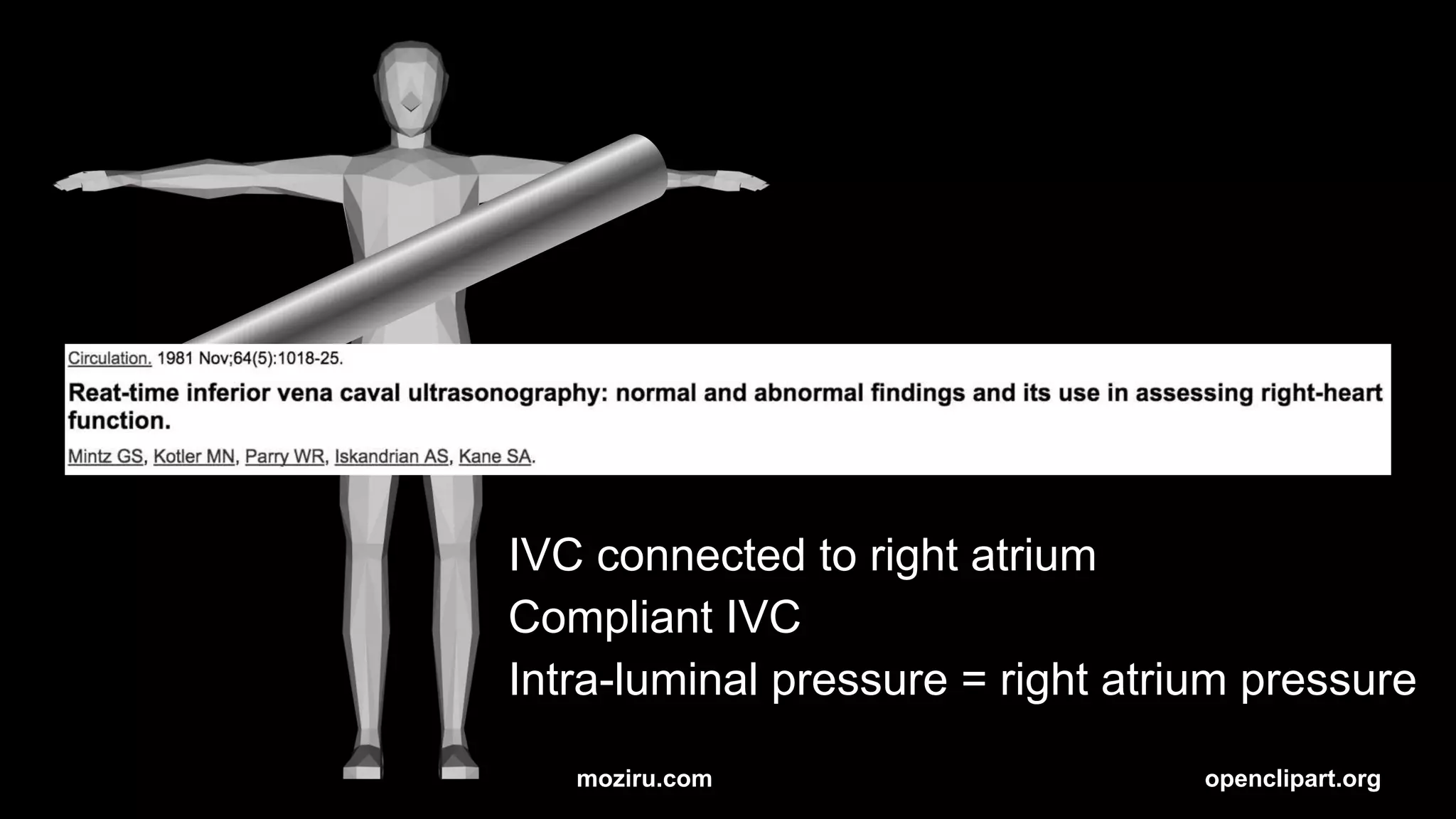 Inferior vena cava ultrasound in Resuscitation - Why I am skeptical | PPTX