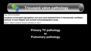 Inferior vena cava ultrasound in Resuscitation - Why I am skeptical | PPTX