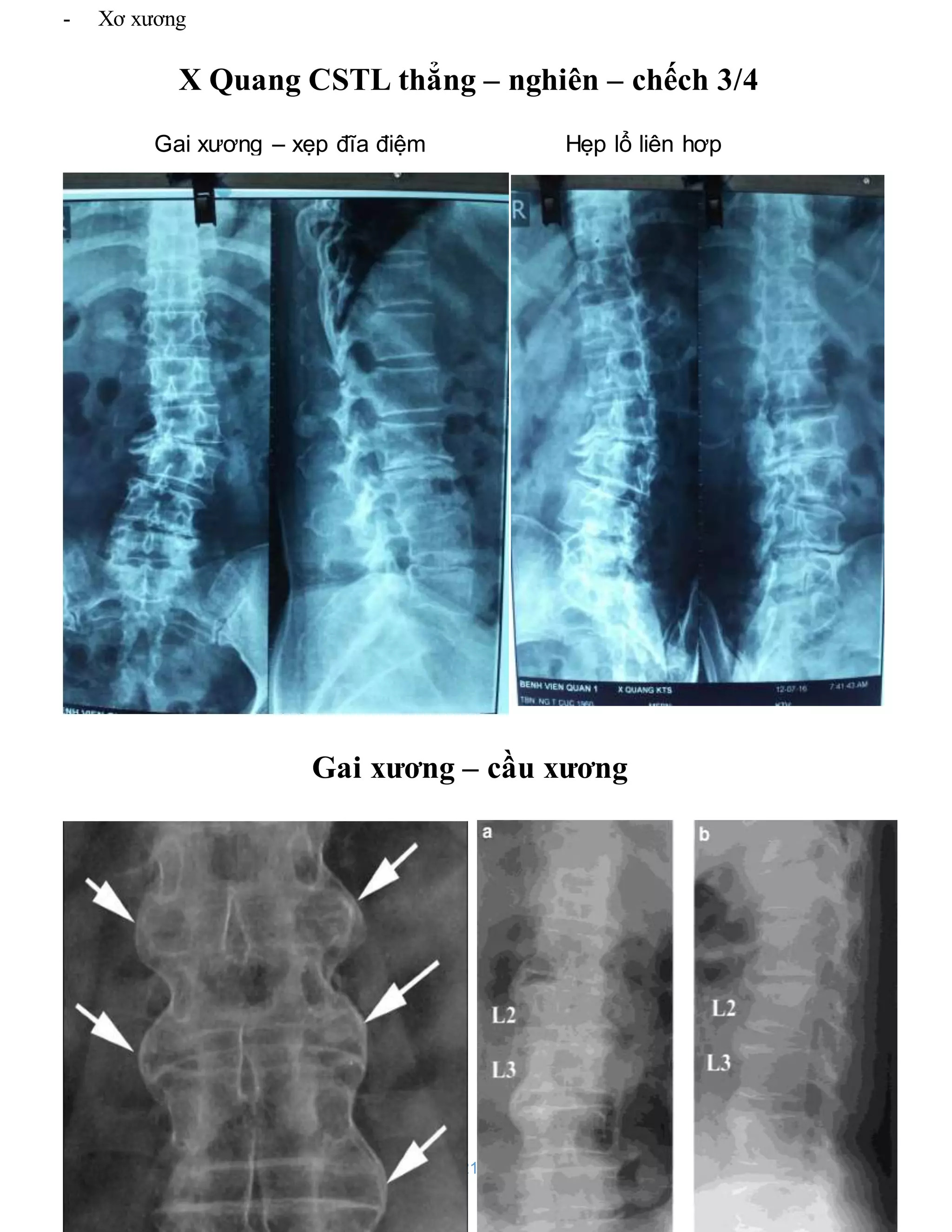 Thoai hoa cot song www | DOCX