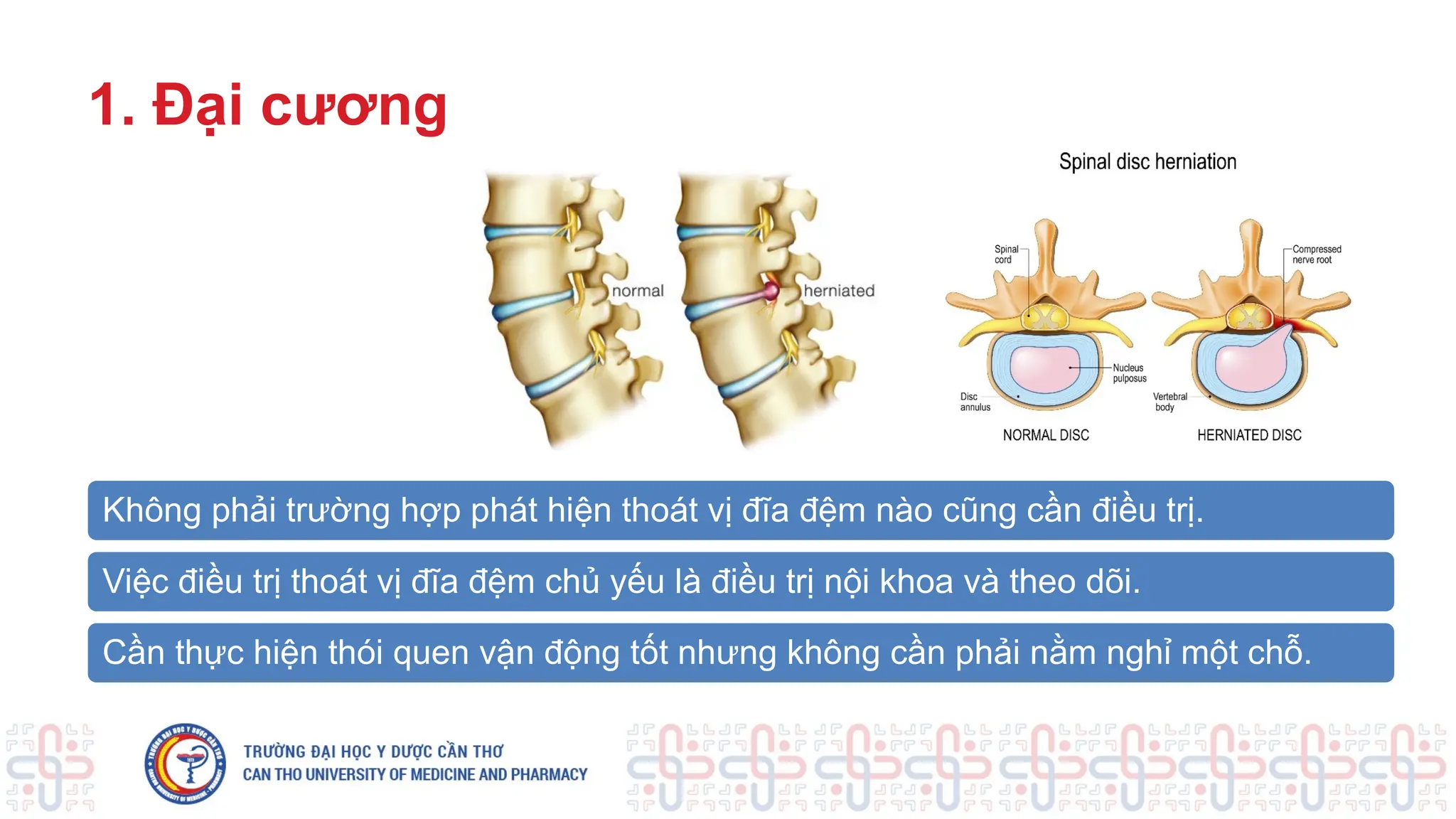 TIEP CAN CHAN DOAN THOÁT VỊ ĐĨA ĐỆM.pdf