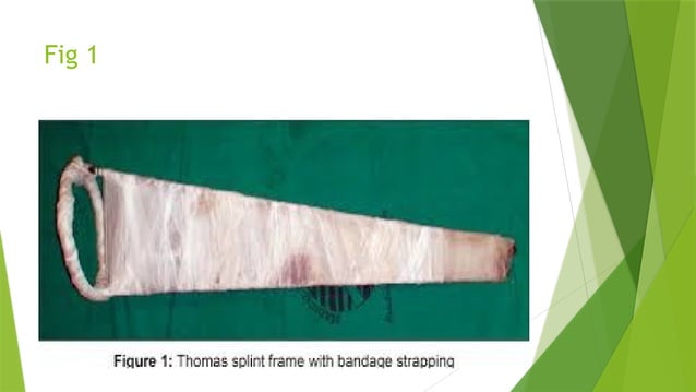 lower limns splinting, Thomas splint.pptx