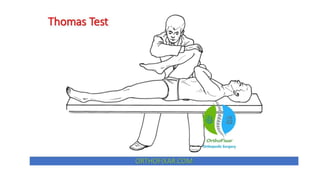 Thomas Test | Iliopsoas Tightness | PPTX