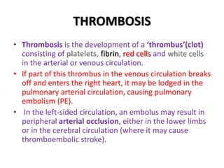 Thrombosis, VTE- PE | PPTX