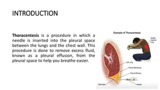 Thoracentesis Procedure