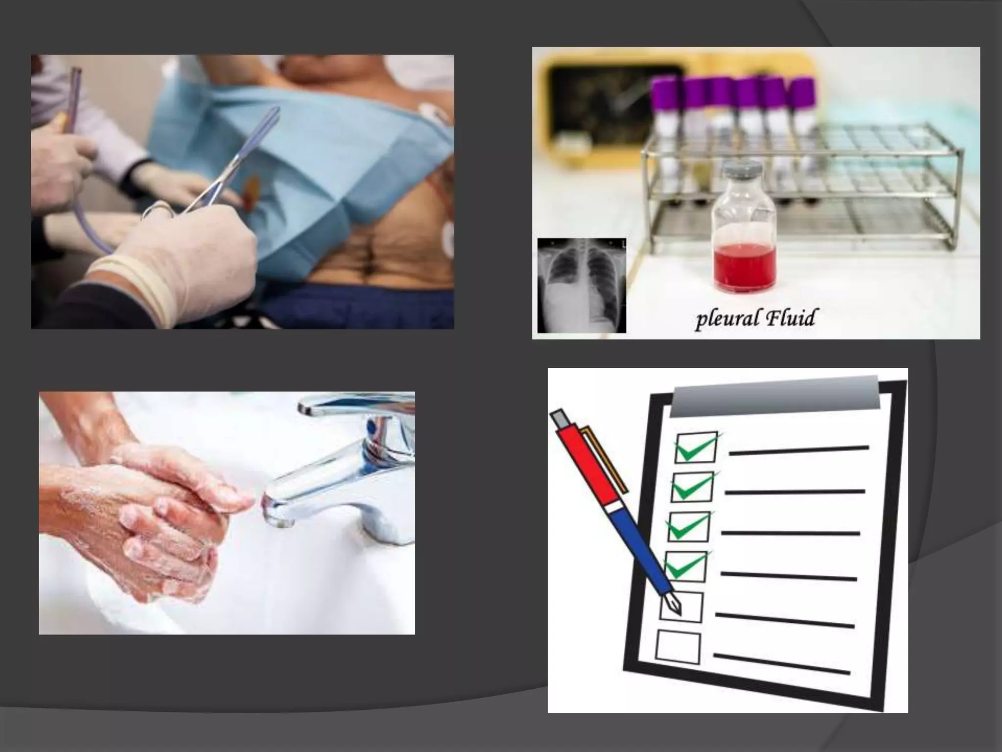 Thoracentesis medical surgical nursing | PPTX